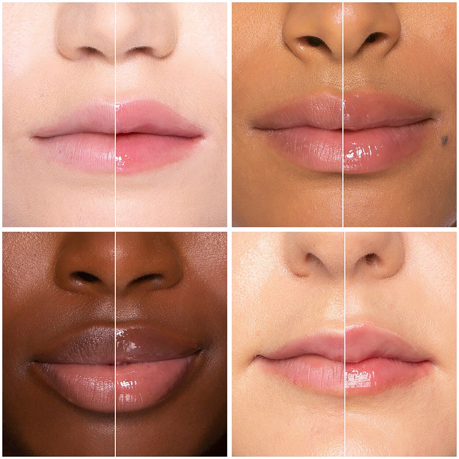 Lip injection by too faced store